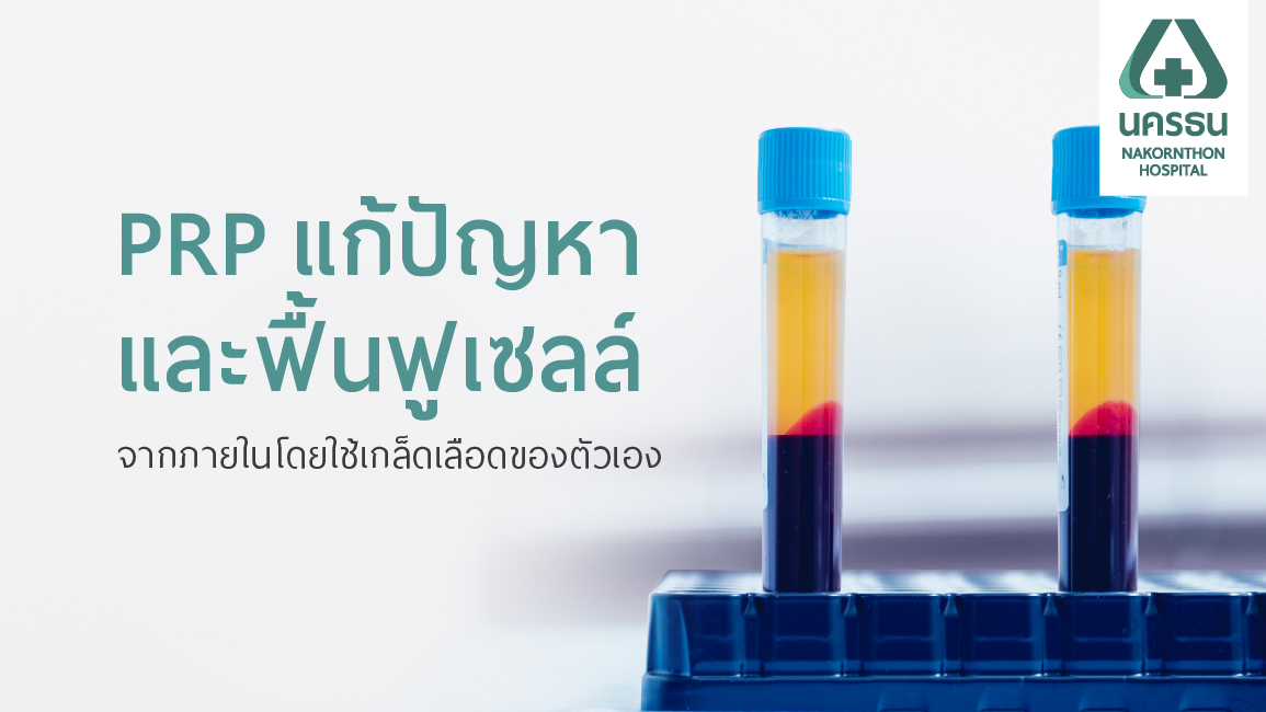 ทำความรู้จัก PRP นวัตกรรมฟื้นฟูจากภายในด้วยเกล็ดเลือดเข้มข้น มีความ ...