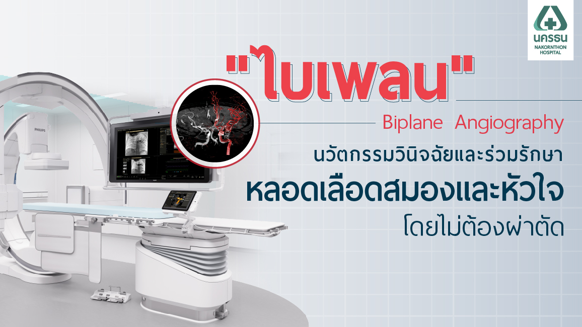 ไบเพลน Biplane นวัตกรรมวินิจฉัยและร่วมรักษาหลอดเลือด | โรงพยาบาลนครธน