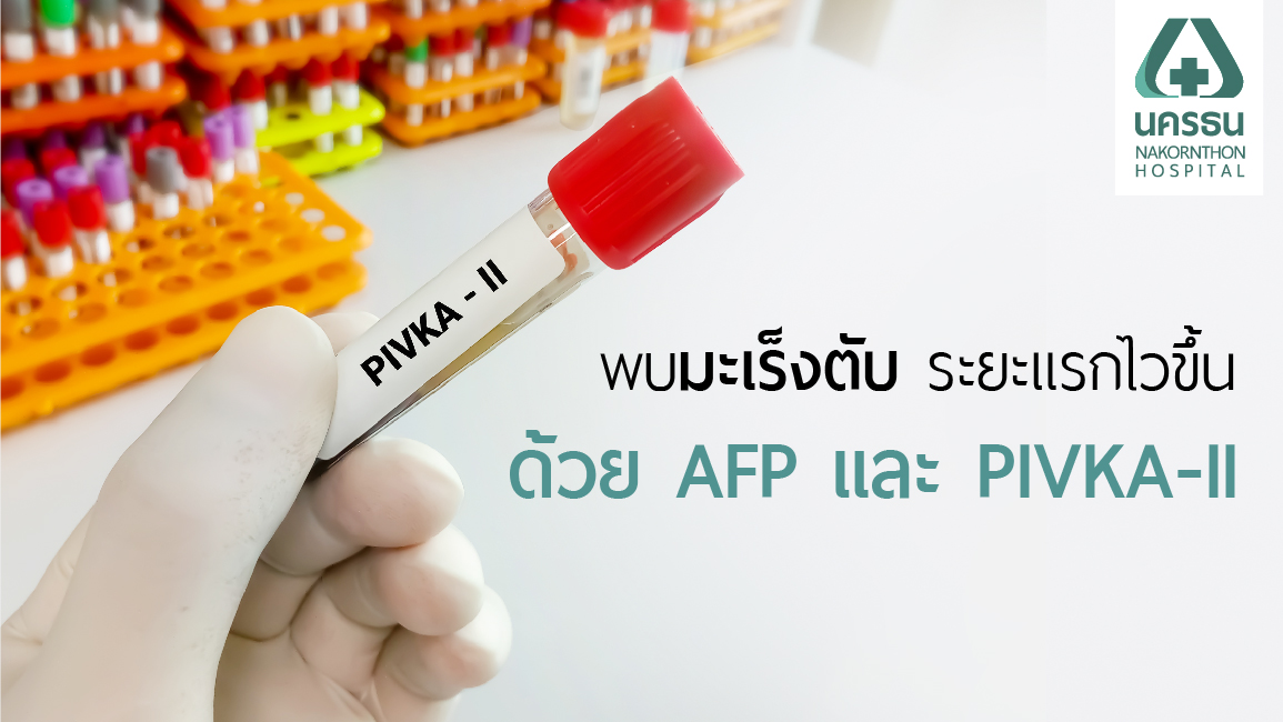 PIVKA-II การตรวจสารบ่งชี้มะเร็งตับชนิดใหม่ เพิ่มประสิทธิภาพในการตรวจคัด ...